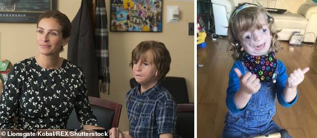 Unui băiețel care suferă de o BOALĂ GENETICĂ RARĂ, nu i se permite ...